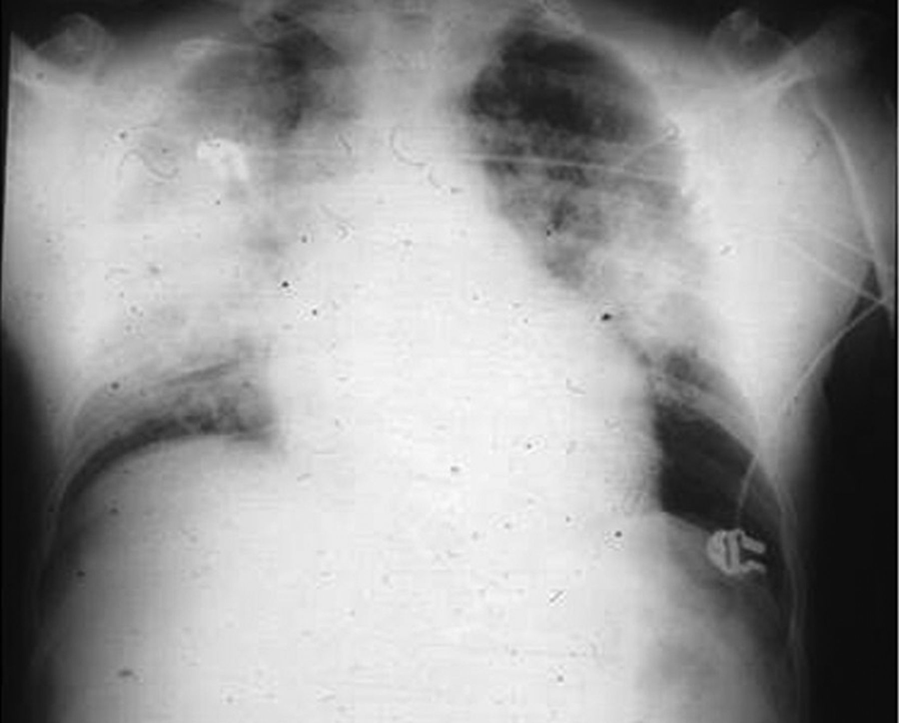 What Happens To An Air Force Pilot After Emergency Ejection